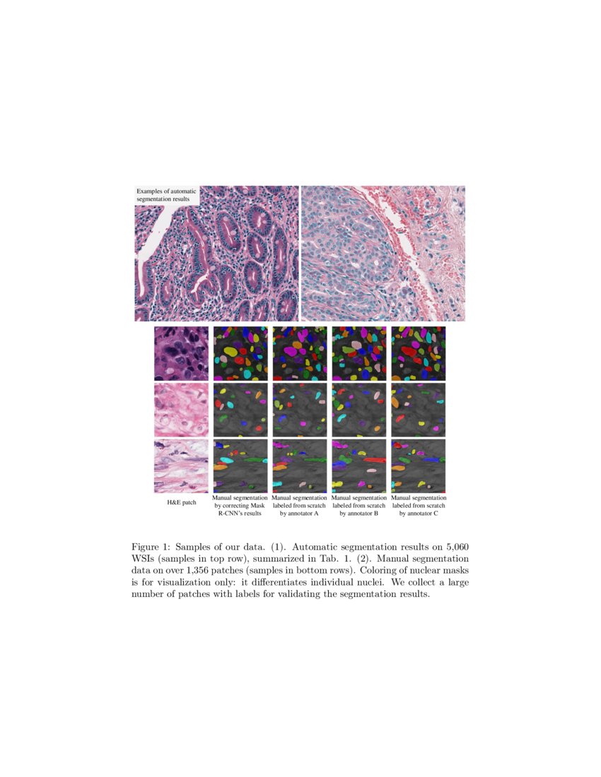 Dataset of Segmented Nuclei in Hematoxylin and Eosin Stained ...