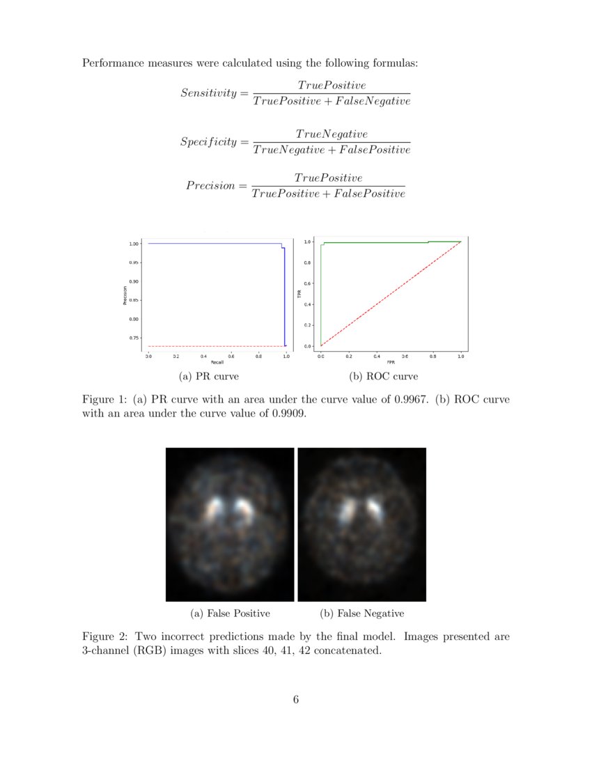 DaTscan SPECT Image Classification for Parkinson's Disease | DeepAI