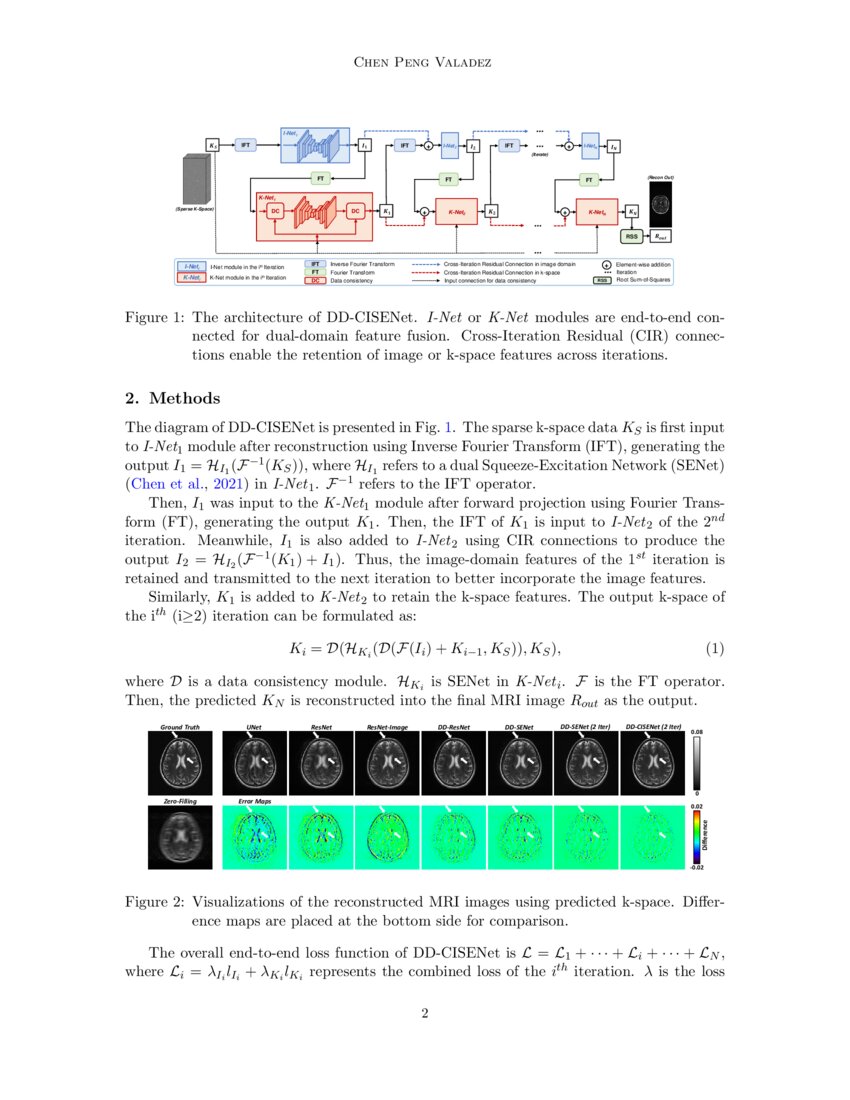 DD-CISENet: Dual-Domain Cross-Iteration Squeeze and Excitation Network ...