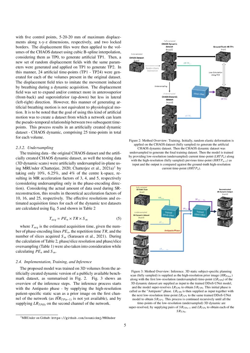 DDoS-UNet: Incorporating temporal information using Dynamic Dual-channel UNet for enhancing ...