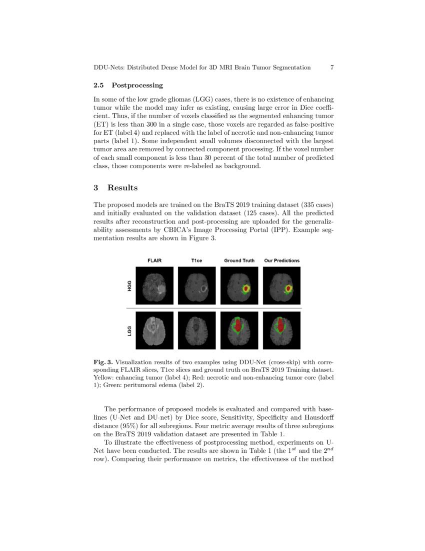 Ddu Nets Distributed Dense Model For 3d Mri Brain Tumor Segmentation