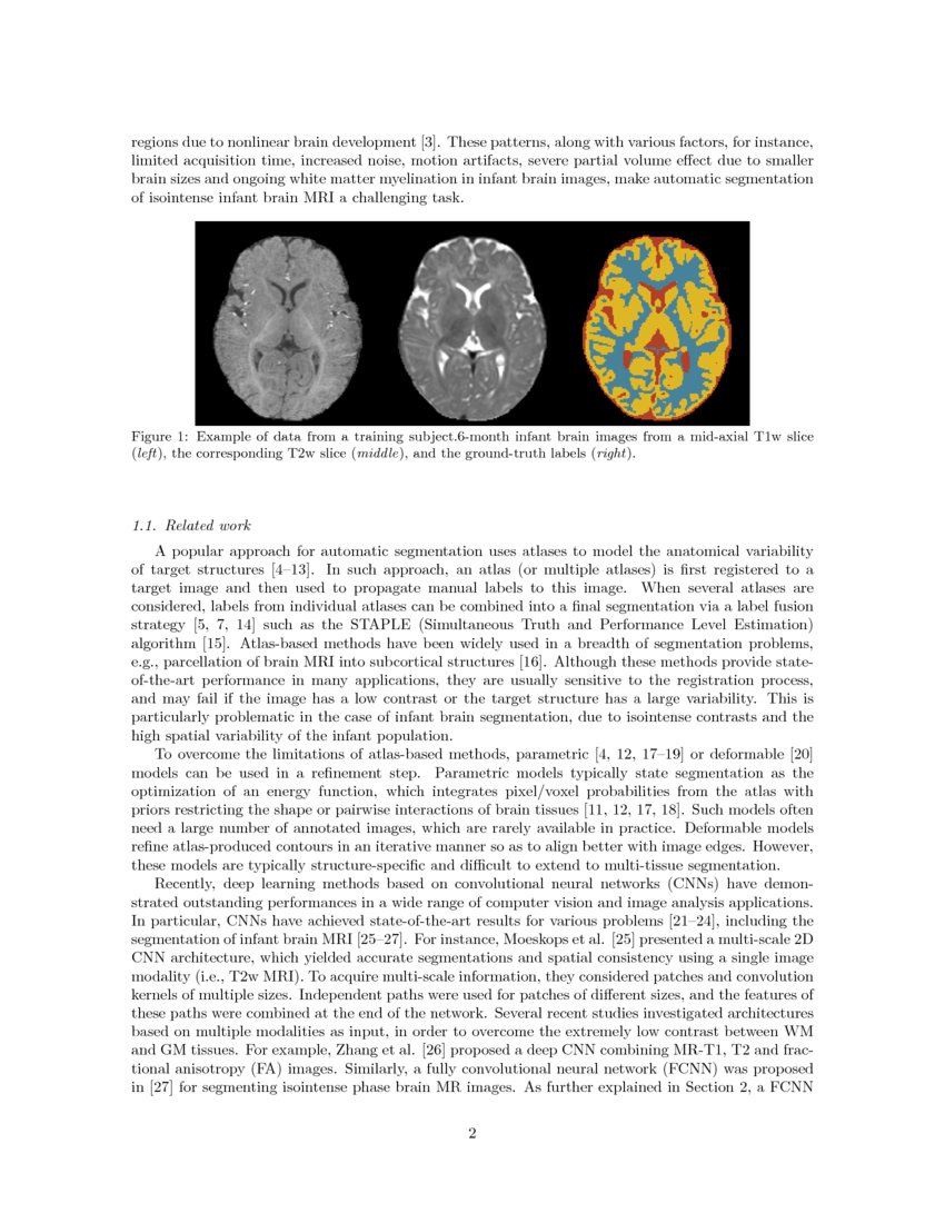 Deep Cnn Ensembles And Suggestive Annotations For Infant Brain Mri Segmentation Deepai