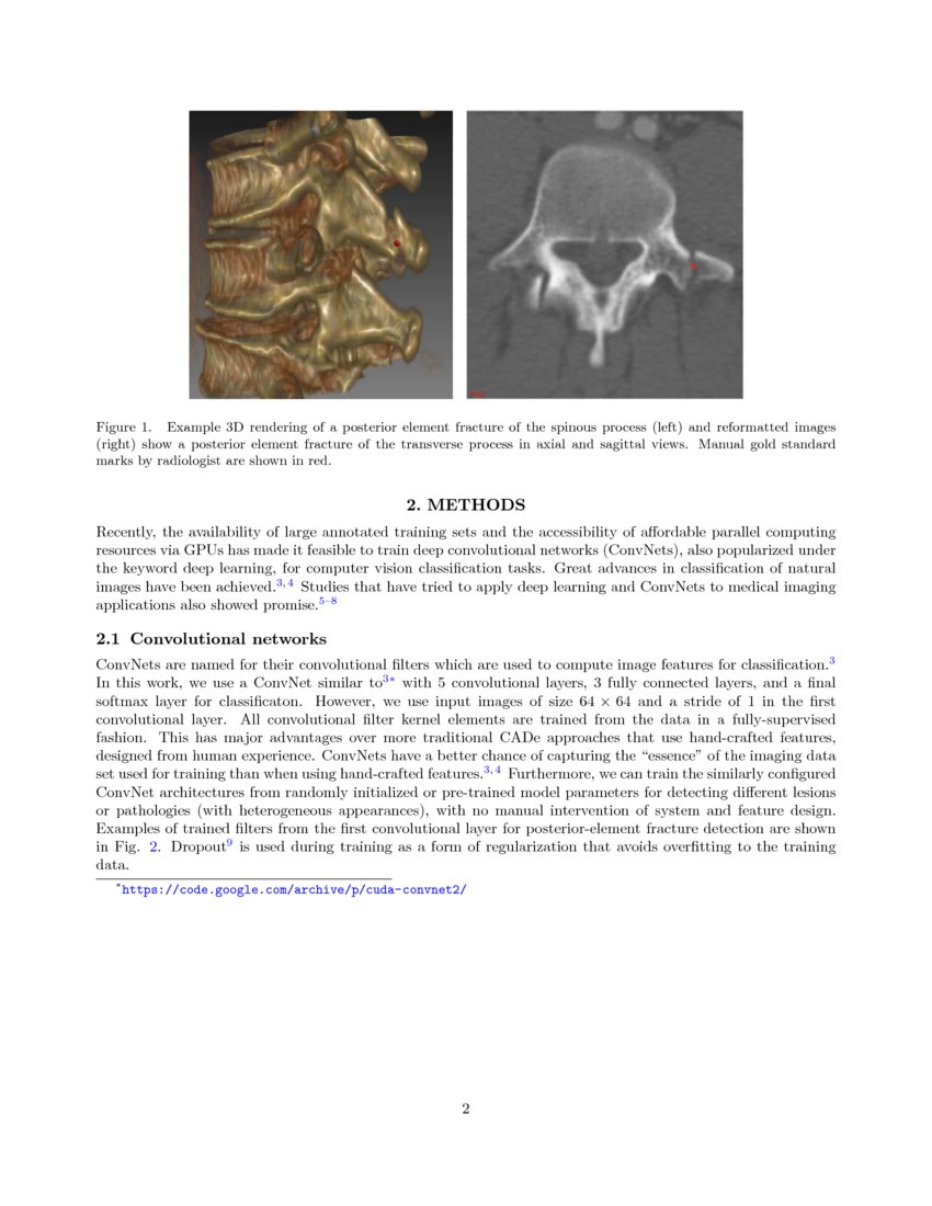 Deep Convolutional Networks For Automated Detection Of Posterior