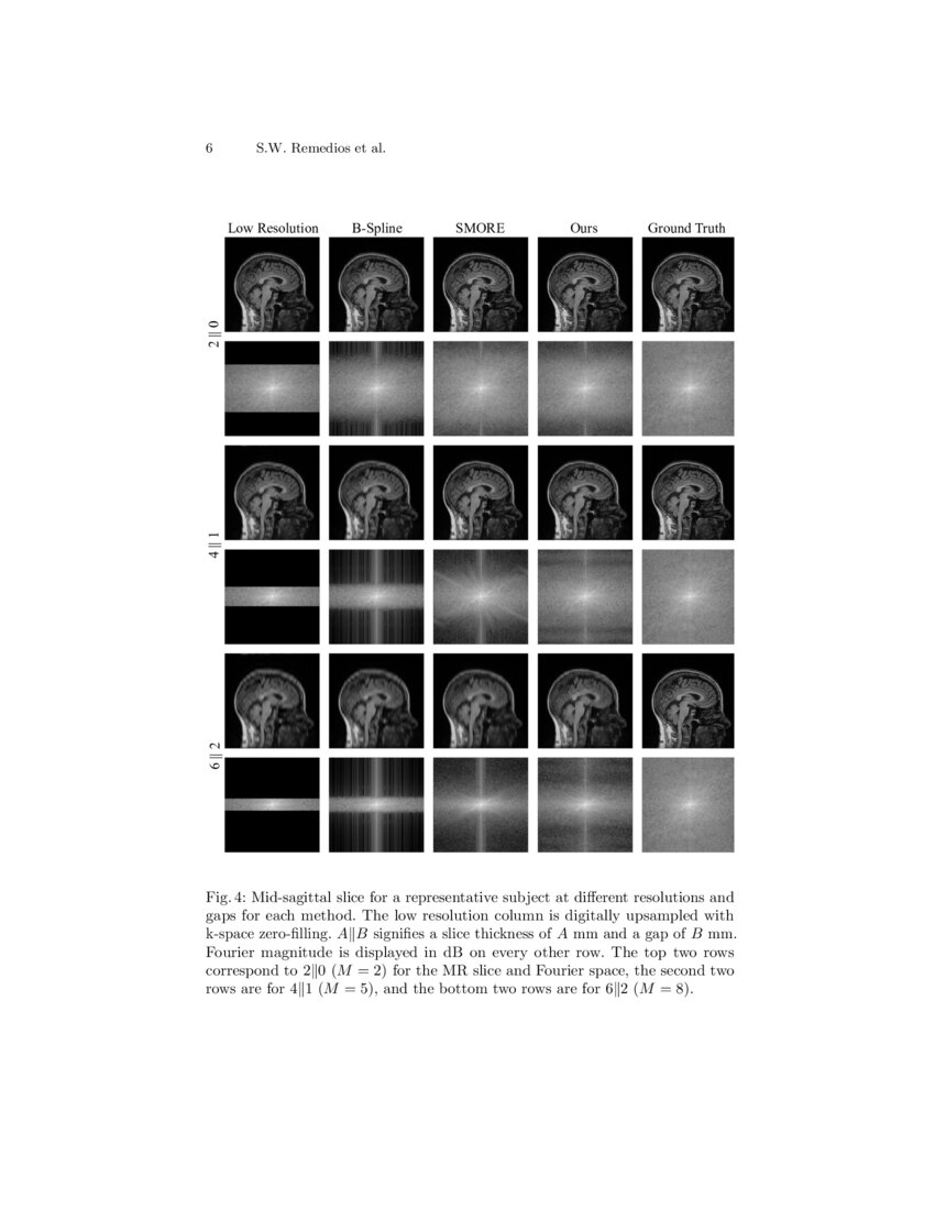 Deep filter bank regression for super-resolution of anisotropic MR ...