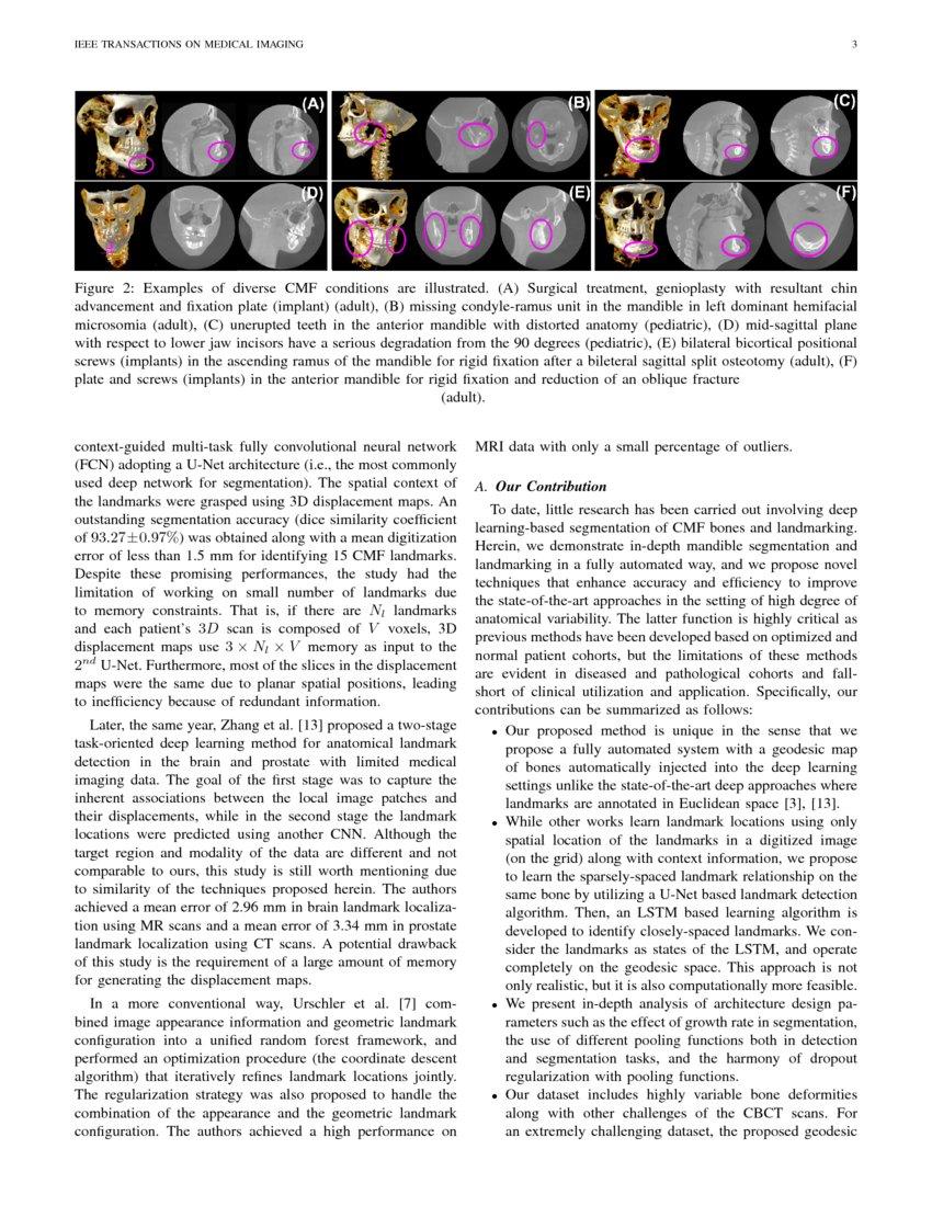 Deep Geodesic Learning for Segmentation and Anatomical Landmarking | DeepAI