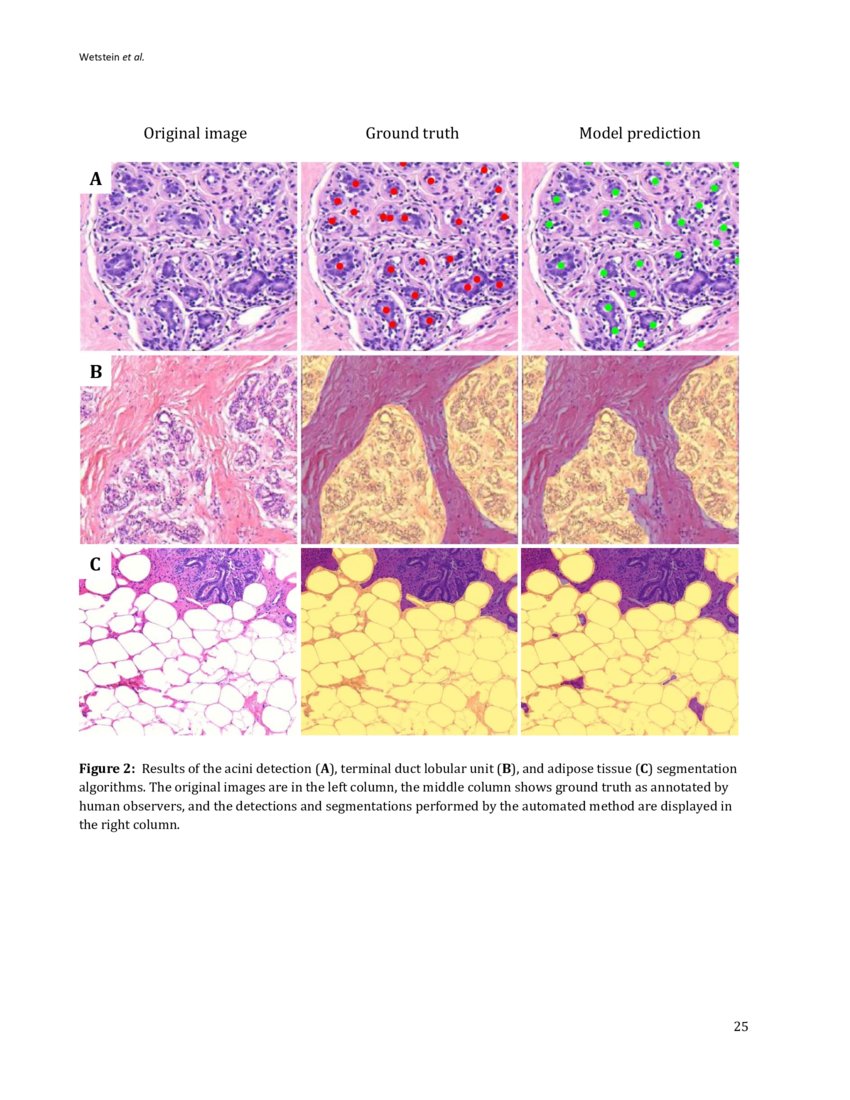 Deep learning assessment of breast terminal duct lobular unit ...