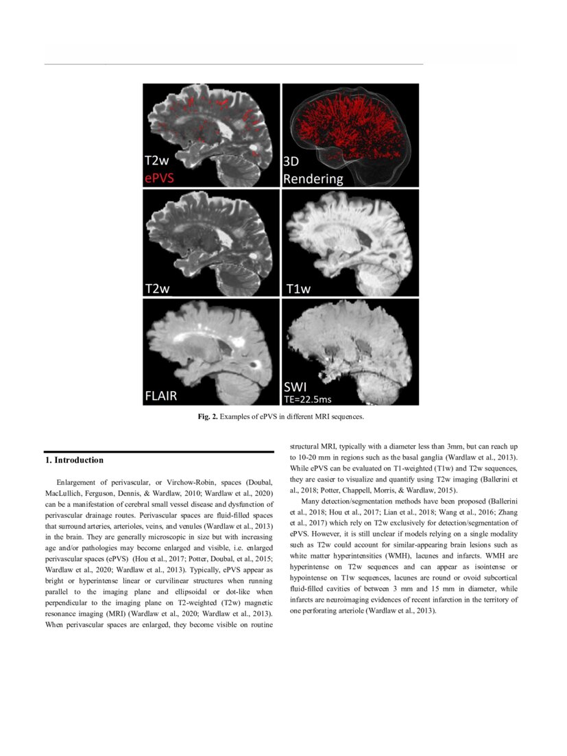 Deep Learning Based Detection of Enlarged Perivascular Spaces on Brain ...