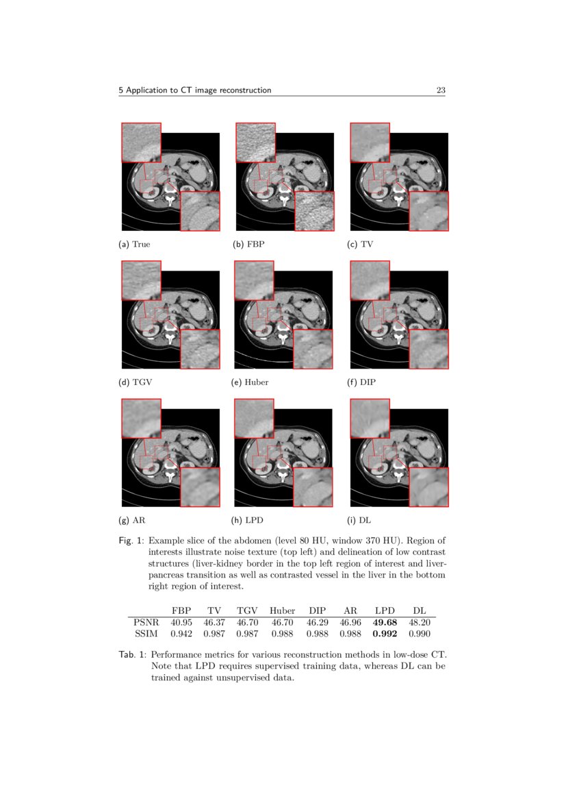 Deep Learning Based Dictionary Learning And Tomographic Image Reconstruction Deepai