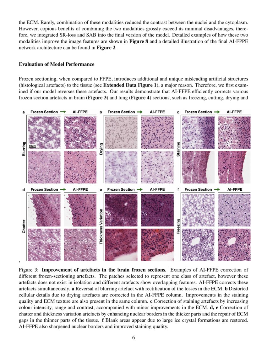 Deep Learning-based Frozen Section to FFPE Translation | DeepAI