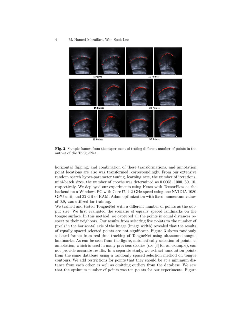 Deep Learning For Automatic Tracking Of Tongue Surface In Real Time Ultrasound Videos Landmarks