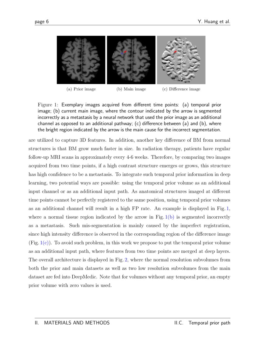 Deep Learning For Brain Metastasis Detection And Segmentation In