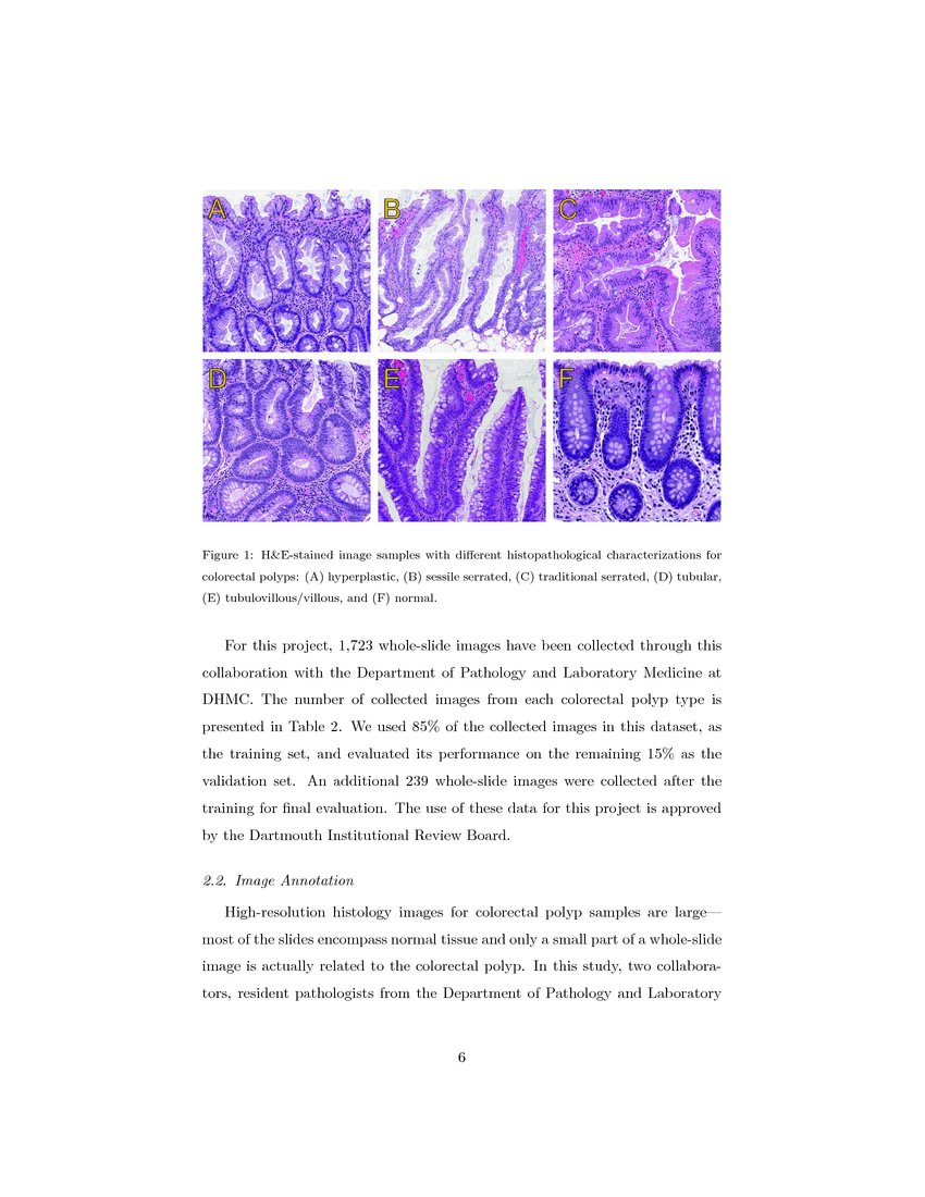 Deep-Learning for Classification of Colorectal Polyps on Whole-Slide ...