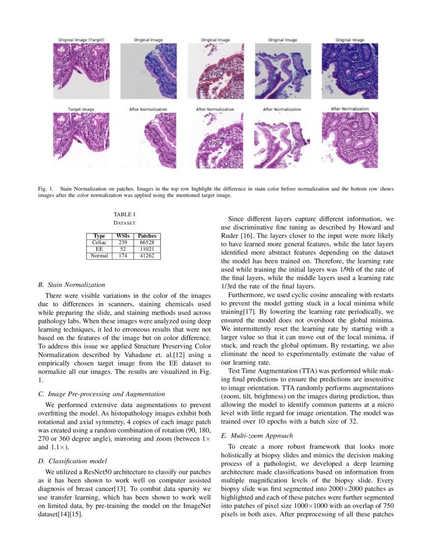 Deep Learning for Visual Recognition of Environmental Enteropathy and ...