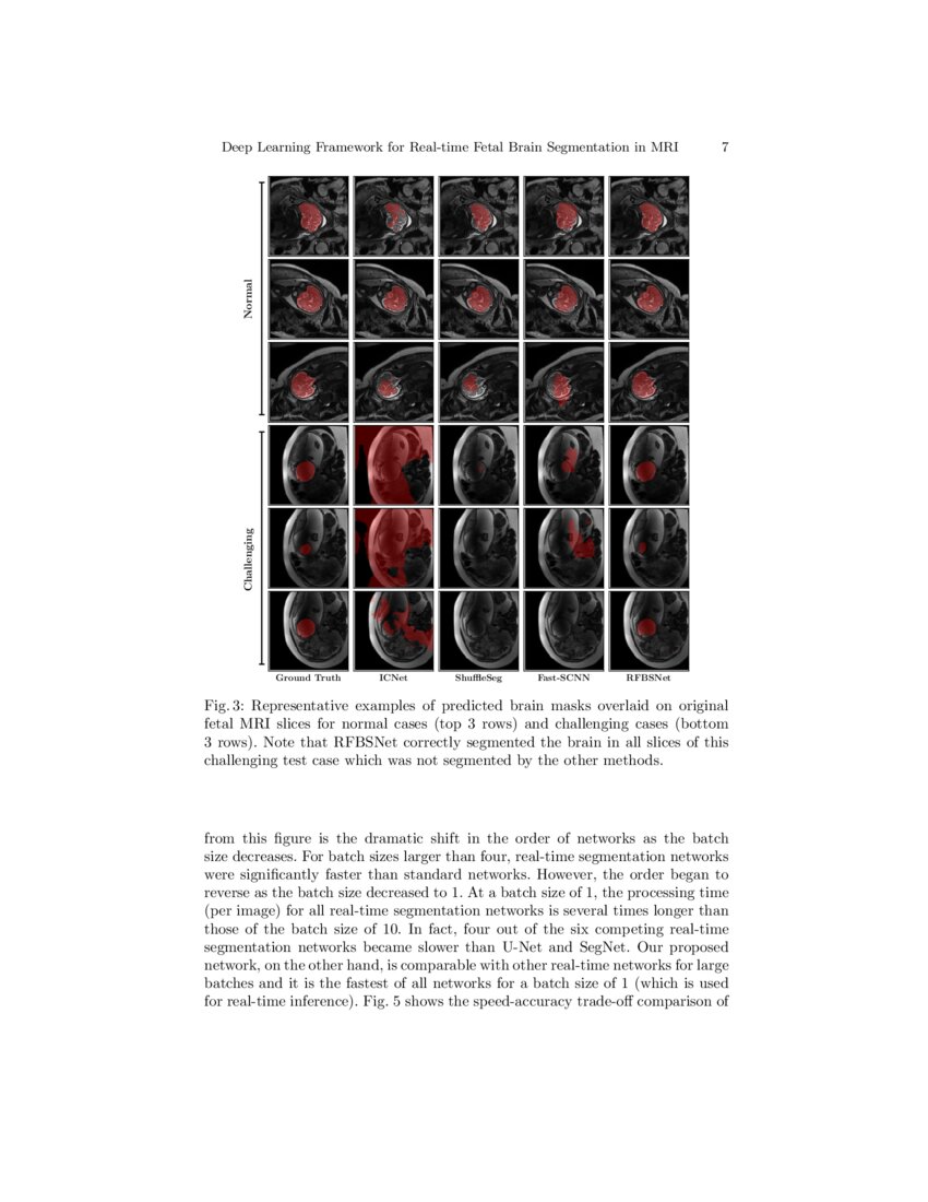 Deep Learning Framework For Real Time Fetal Brain Segmentation In Mri