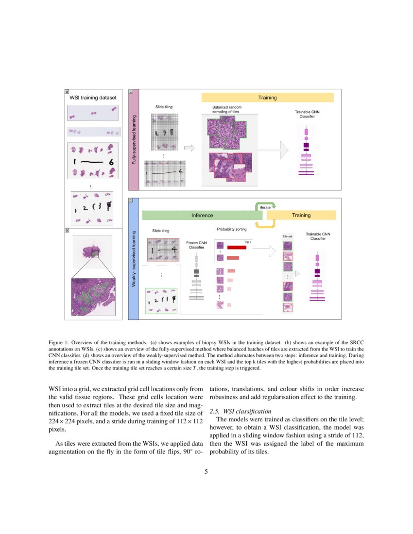 Deep learning models for gastric signet ring cell carcinoma ...