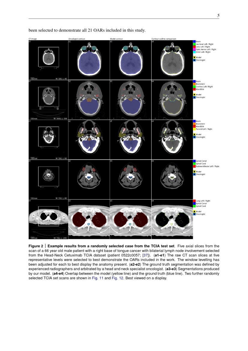 Deep learning to achieve clinically applicable segmentation of head and ...