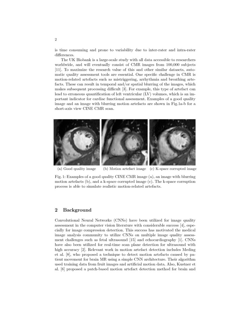 Deep Learning using K-space Based Data Augmentation for Automated ... Deep Learning using K-space Based Data Augmentation for Automated ...