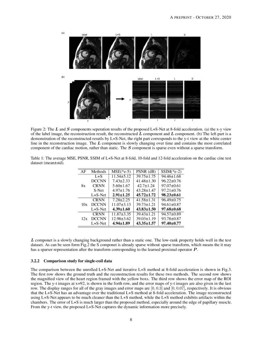 Deep Low-rank plus Sparse Network for Dynamic MR Imaging | DeepAI