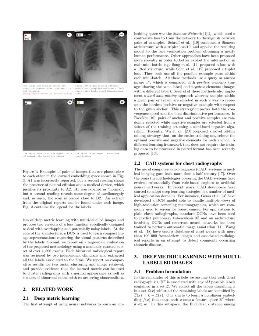 Deep metric learning for multi-labelled radiographs | DeepAI