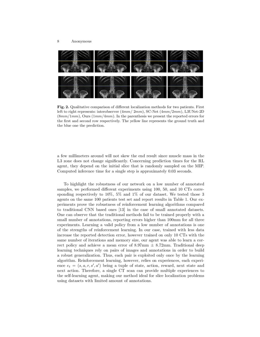 Deep Reinforcement Learning For L3 Slice Localization In Sarcopenia