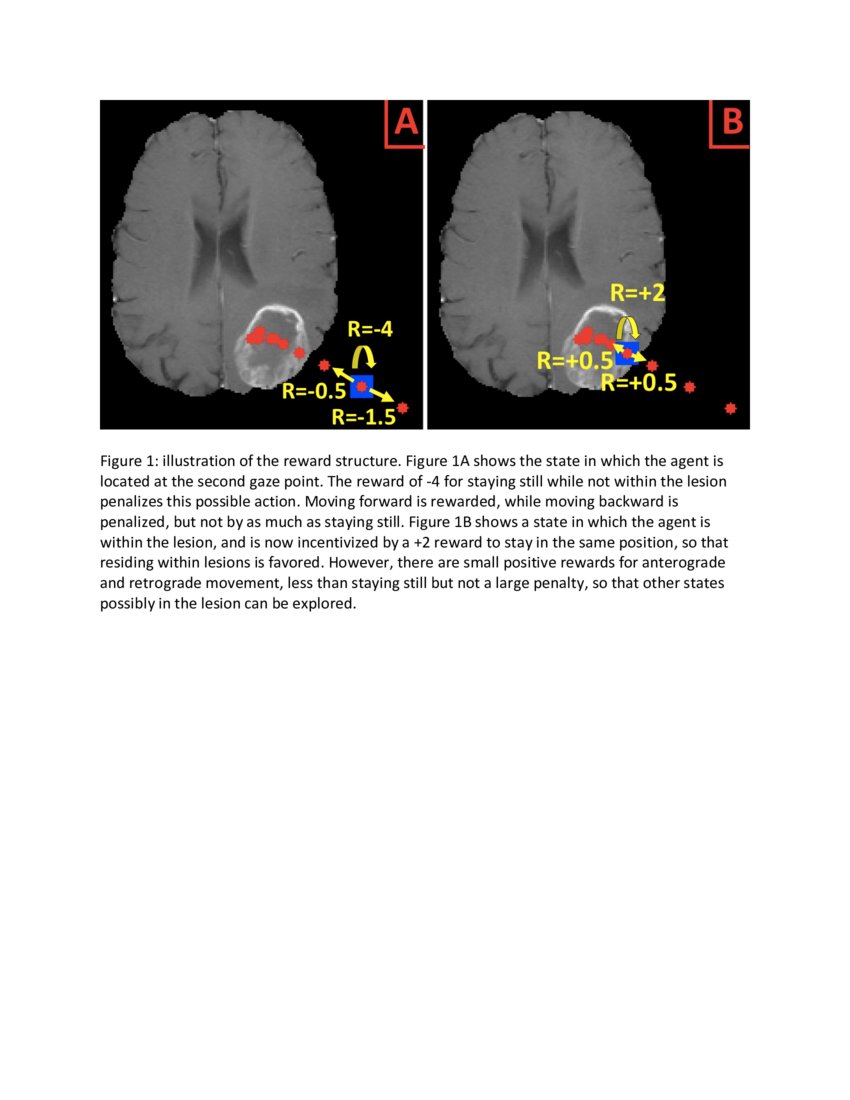 Deep reinforcement learning to detect brain lesions on MRI: a proof-of ...
