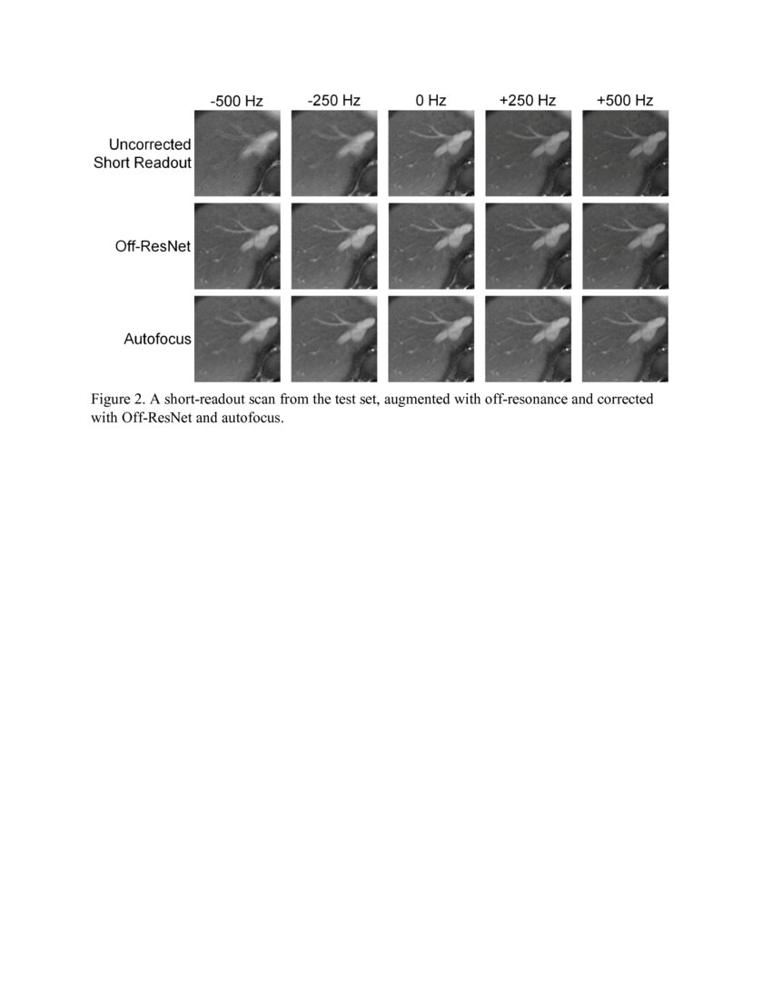 Deep Residual Network For Off Resonance Artifact Correction With