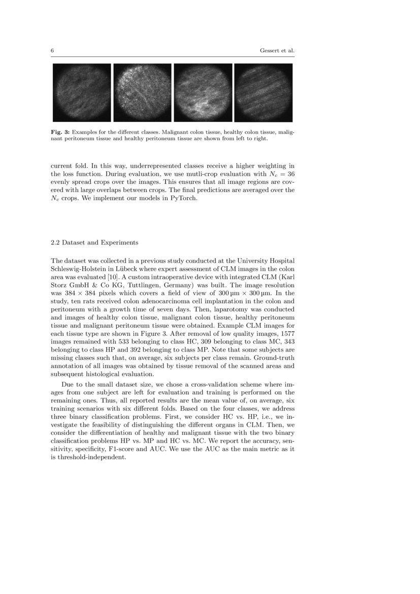 Deep Transfer Learning Methods for Colon Cancer Classification in Confocal Laser Microscopy ...