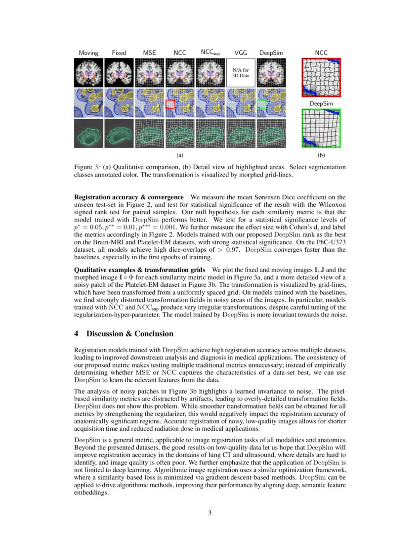 DeepSim: Semantic similarity metrics for learned image registration | DeepAI