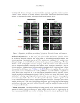 DeepSPINE: Automated Lumbar Vertebral Segmentation, Disc-level Designation, and Spinal Stenosis ...