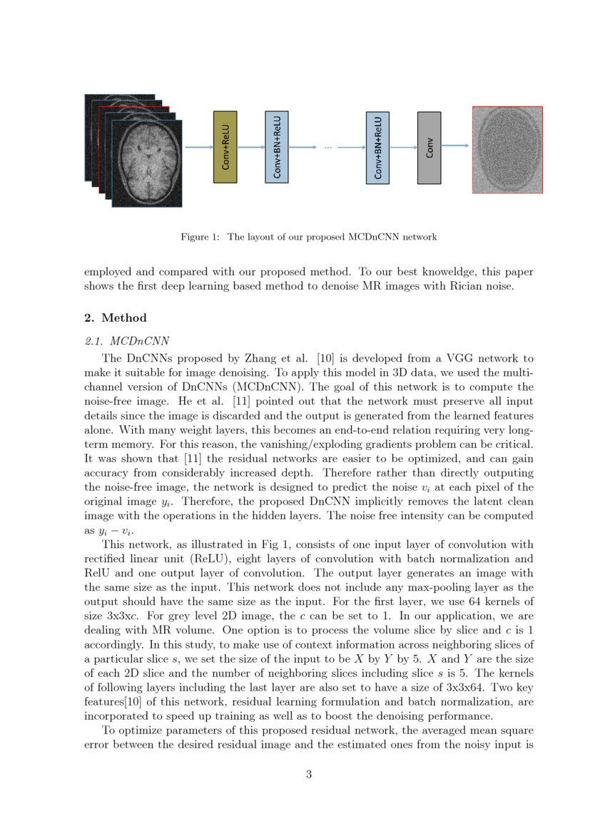 Denoising of 3D magnetic resonance images with multi-channel residual ... Denoising of 3D magnetic resonance images with multi-channel residual ...