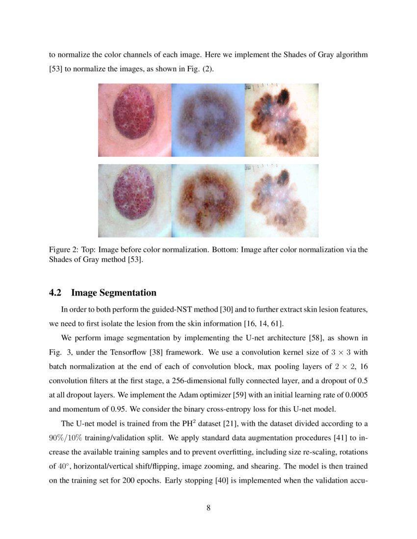 Dermoscopic Image Classification with Neural Style Transfer | DeepAI