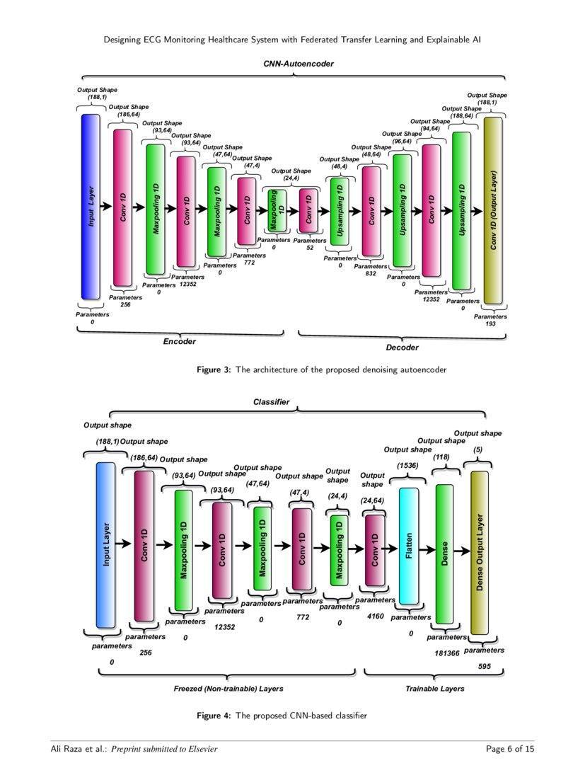 Designing ECG Monitoring Healthcare System with Federated Transfer ...