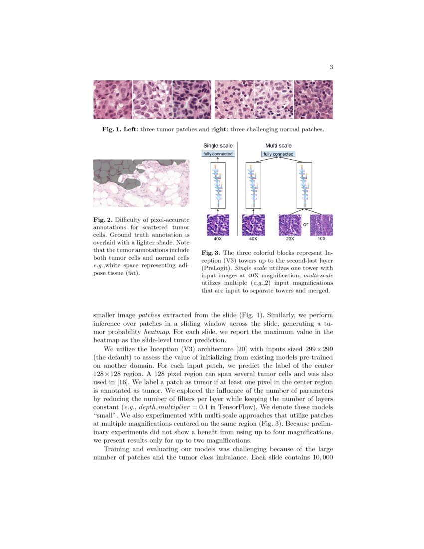 Detecting Cancer Metastases on Gigapixel Pathology Images | DeepAI