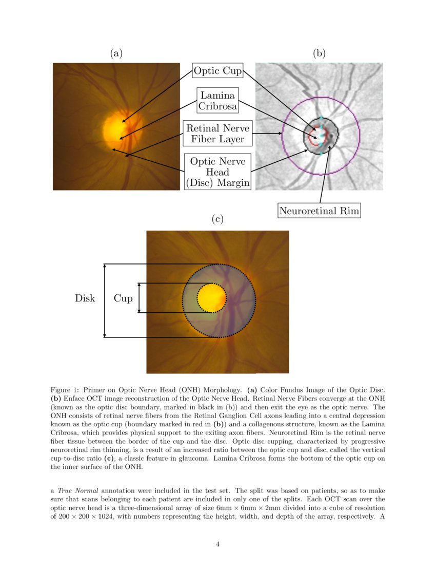 Detecting Glaucoma Using 3d Convolutional Neural Network Of Raw Sd Oct