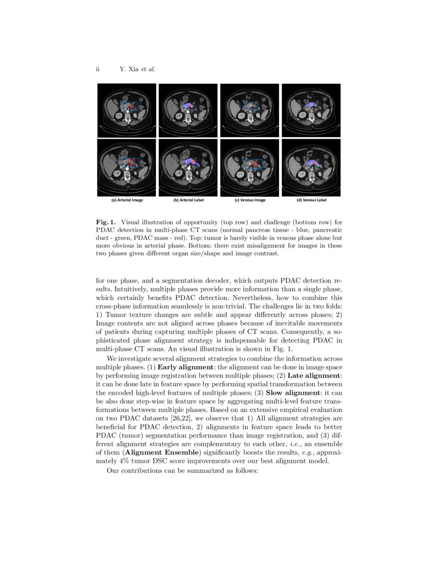 Detecting Pancreatic Adenocarcinoma in Multi-phase CT Scans via ...