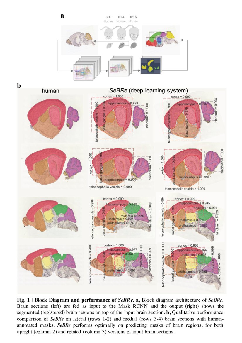 Developing Brain Atlas through Deep Learning | DeepAI