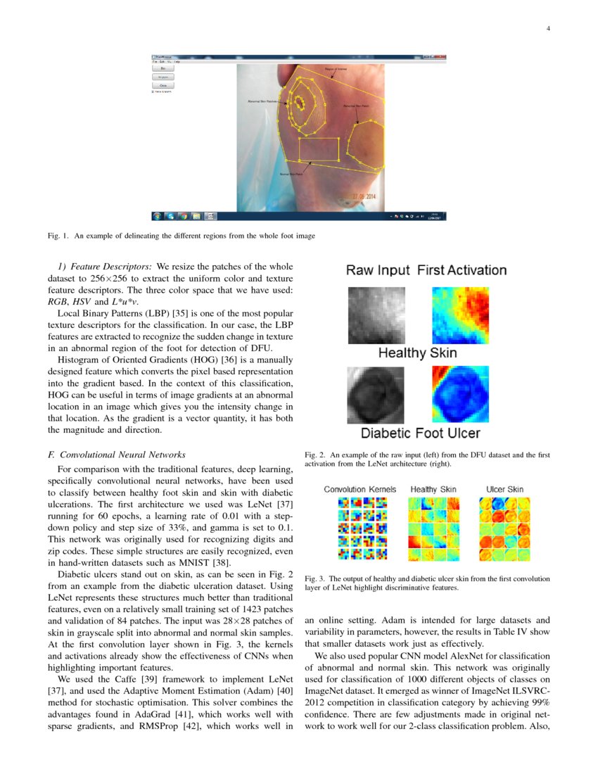 DFUNet: Convolutional Neural Networks for Diabetic Foot Ulcer Classification | DeepAI