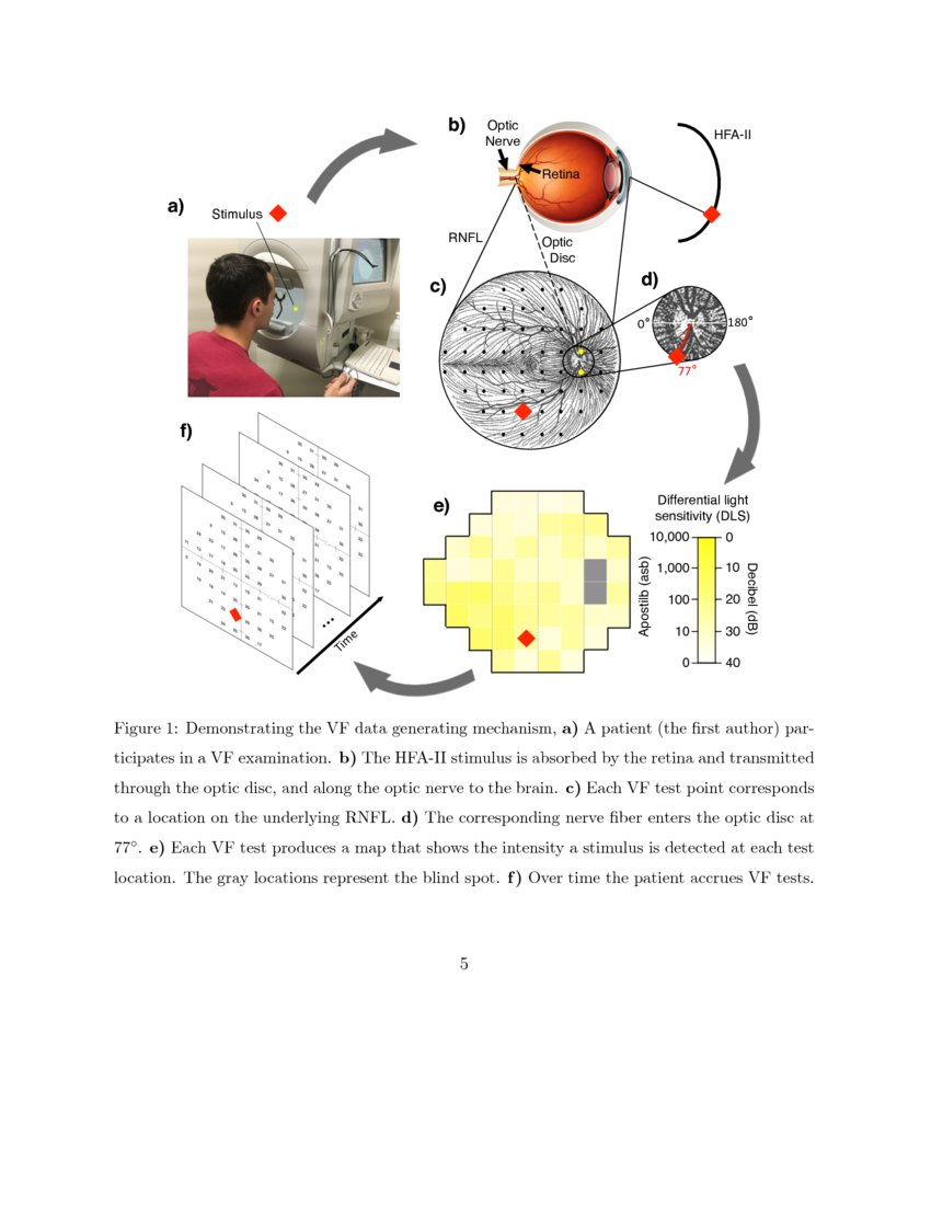 Diagnosing Glaucoma Progression With Visual Field Data Using A Spatiotemporal Boundary Detection