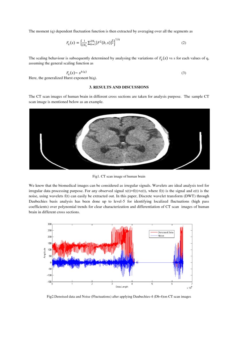 Diagnosing Heterogeneous Dynamics for CT Scan Images of Human Brain in ...