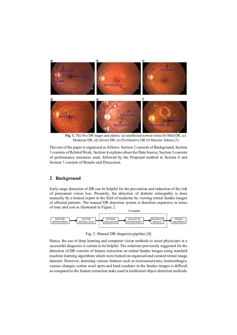 DiaRet: A browser-based application for the grading of Diabetic ...