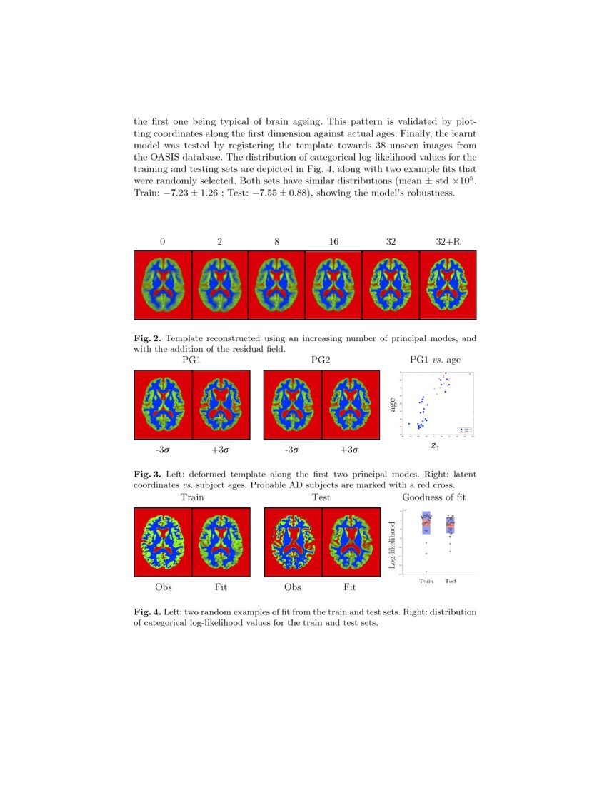 Diffeomorphic brain shape modelling using Gauss-Newton optimisation ...