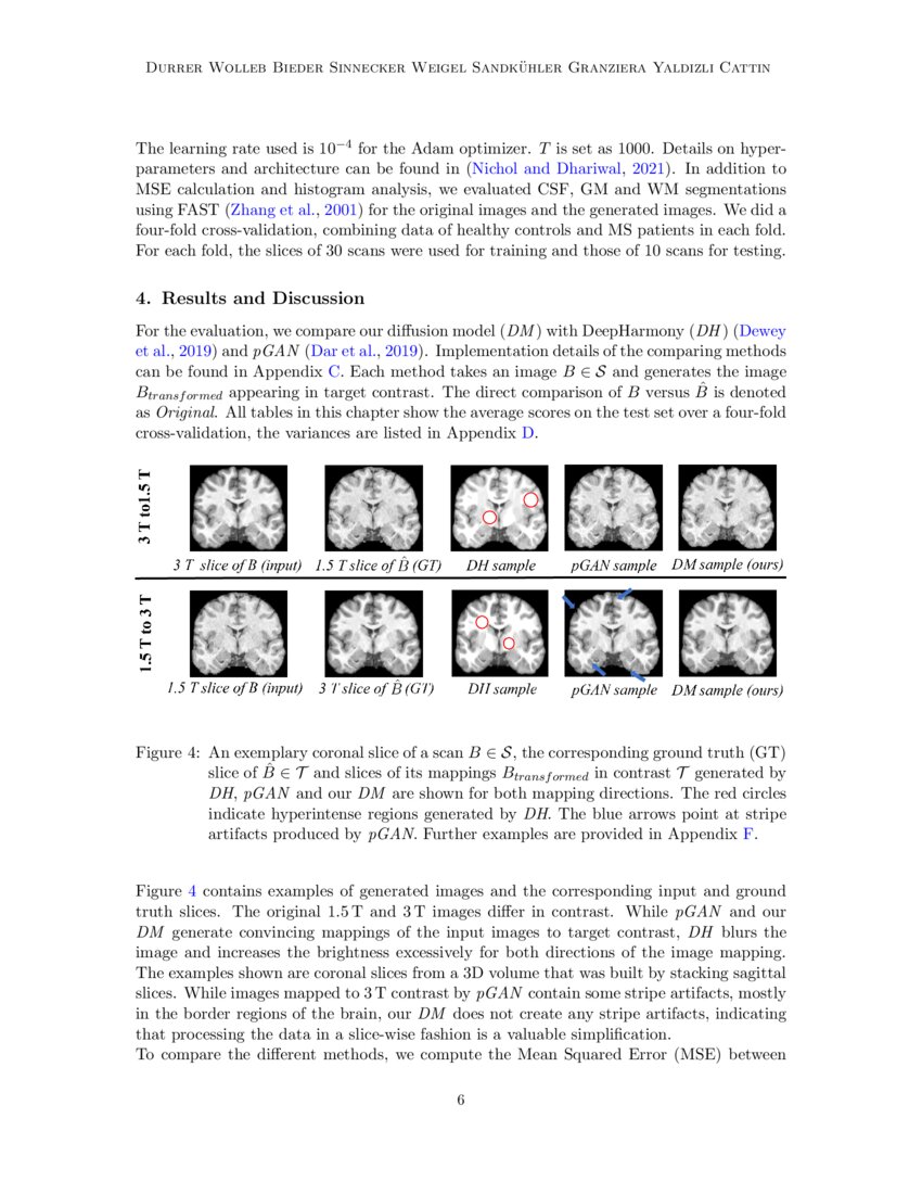 Diffusion Models for Contrast Harmonization of Magnetic Resonance ...