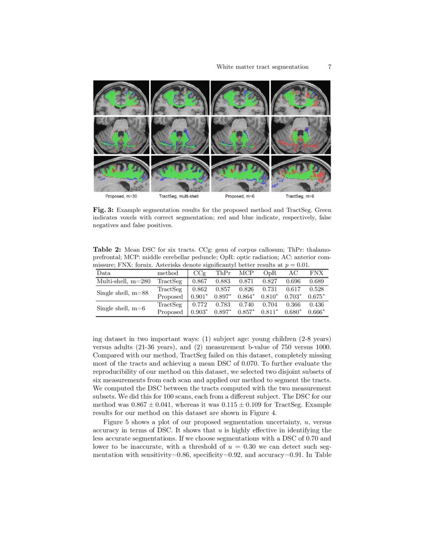 Direct segmentation of brain white matter tracts in diffusion MRI | DeepAI