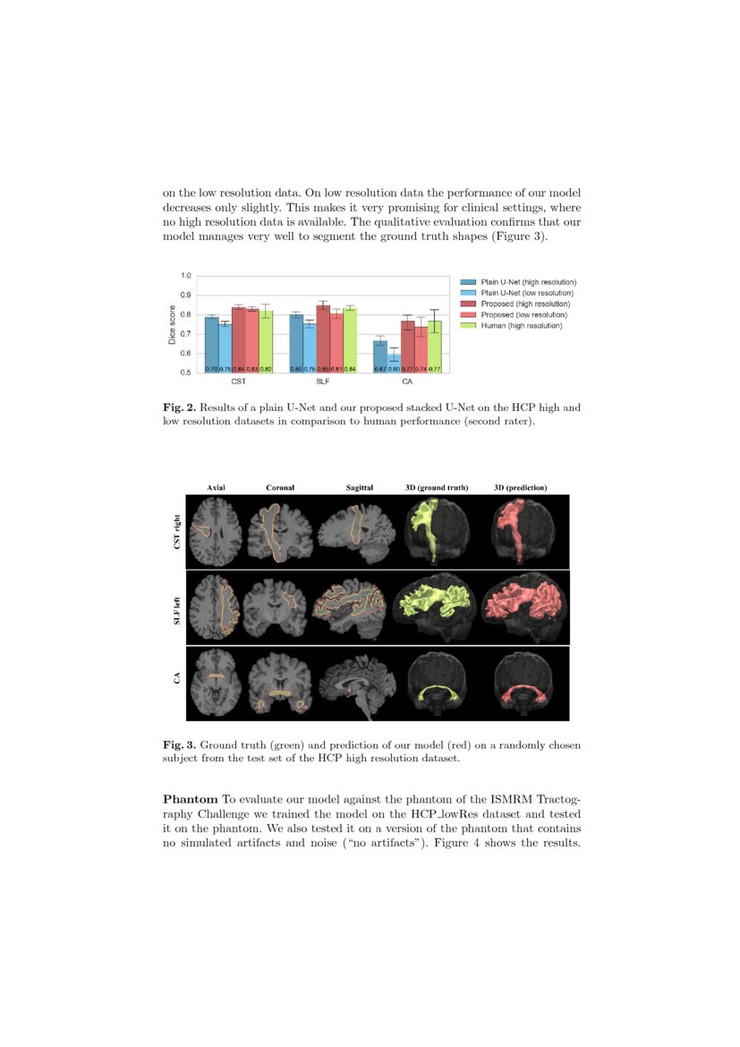 Direct White Matter Bundle Segmentation using Stacked U-Nets | DeepAI