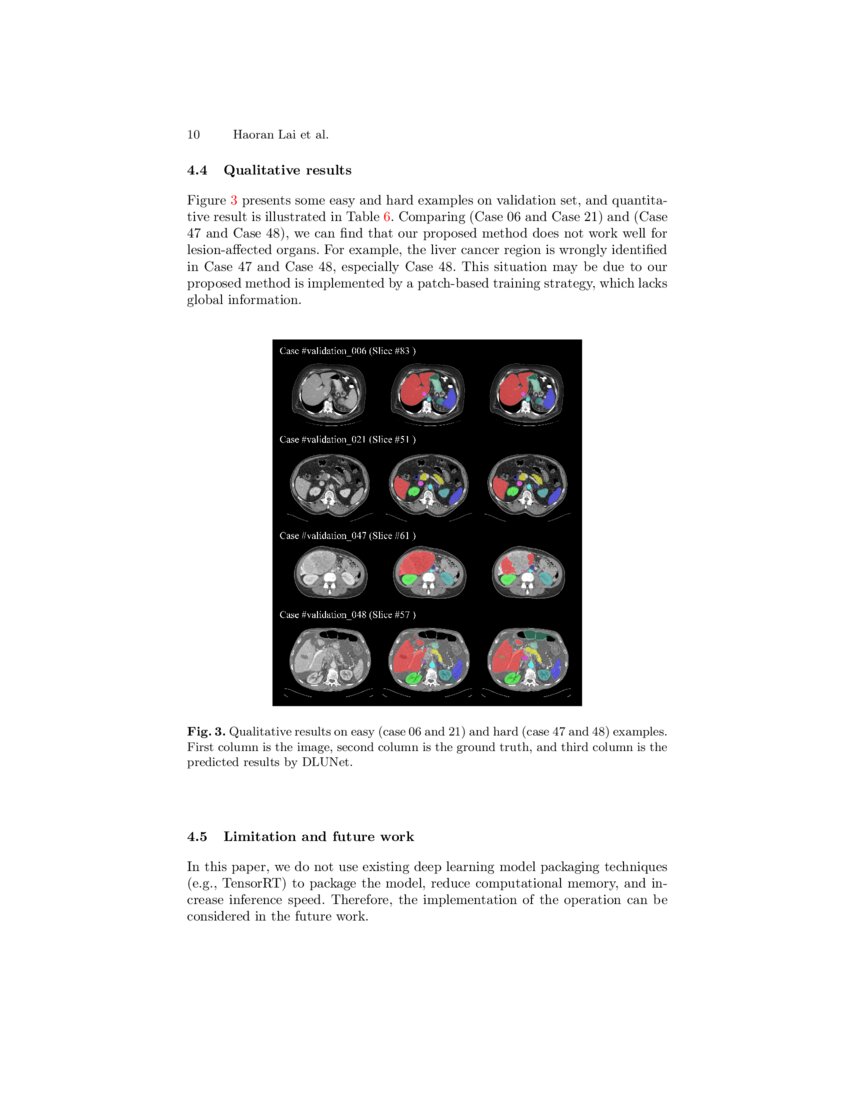 DLUNet: Semi-supervised Learning based Dual-Light UNet for Multi-organ ... DLUNet: Semi-supervised Learning based Dual-Light UNet for Multi-organ ...