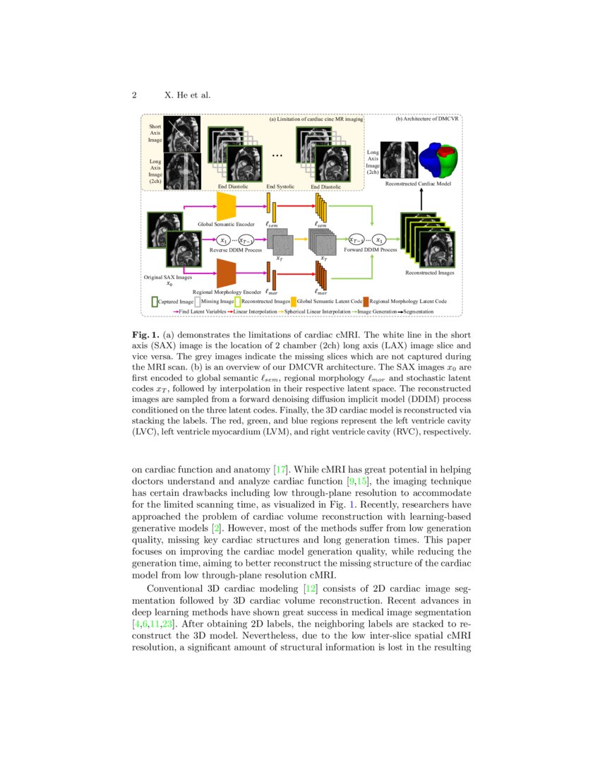 DMCVR: Morphology-Guided Diffusion Model for 3D Cardiac Volume Reconstruction | DeepAI