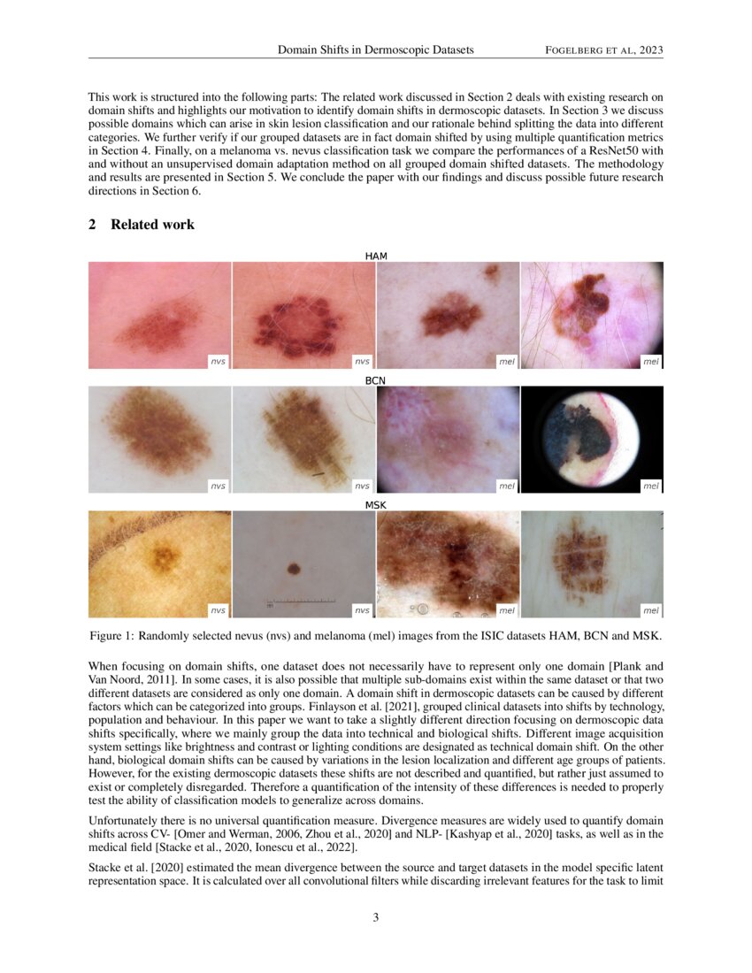 Domain shifts in dermoscopic skin cancer datasets: Evaluation of ...