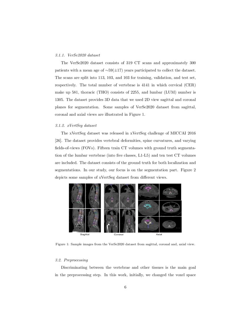 Doubleu Net Architecture With Exploit Multiscale Features For Vertebrae Segmentation Deepai