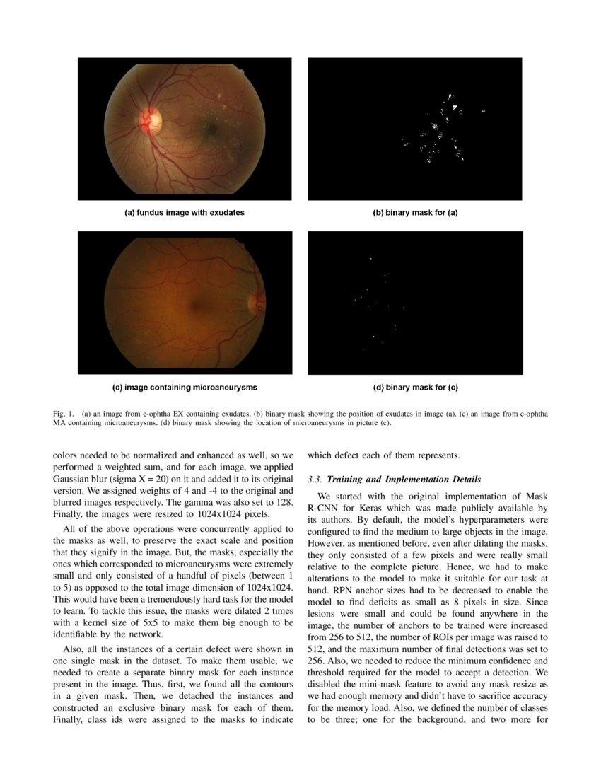 DRDr: Automatic Masking of Exudates and Microaneurysms Caused By ...