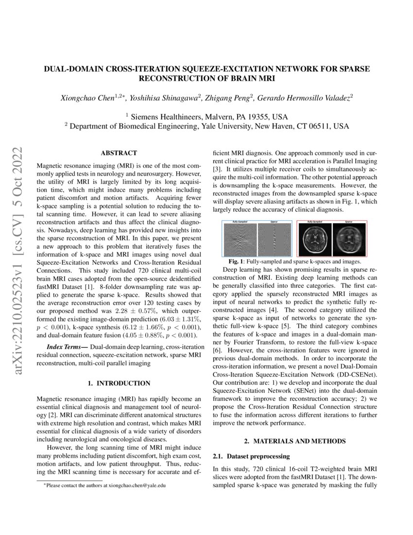 Dual Domain Cross Iteration Squeeze Excitation Network For Sparse